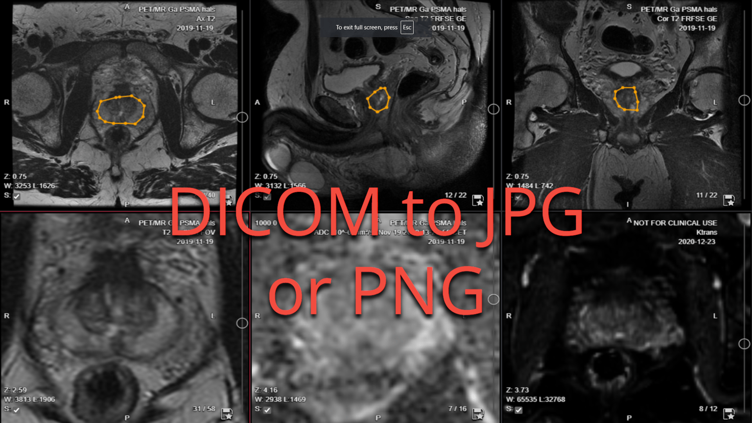 What Is DICOM? Understanding the Standard Powering Modern Medical Imaging