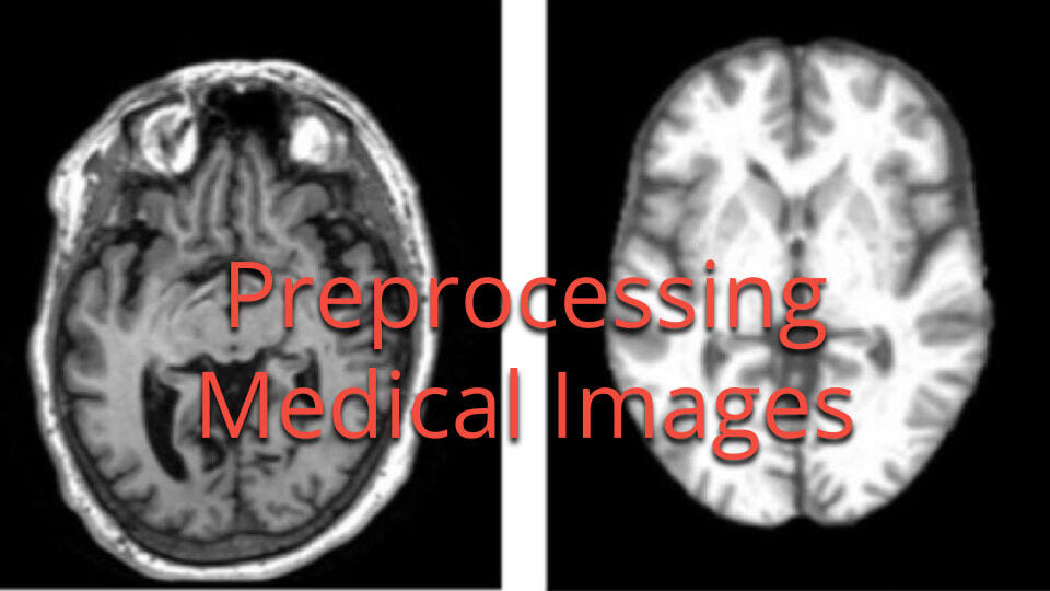 The Ultimate Guide to Preprocessing Medical Images: Techniques, Tools ...
