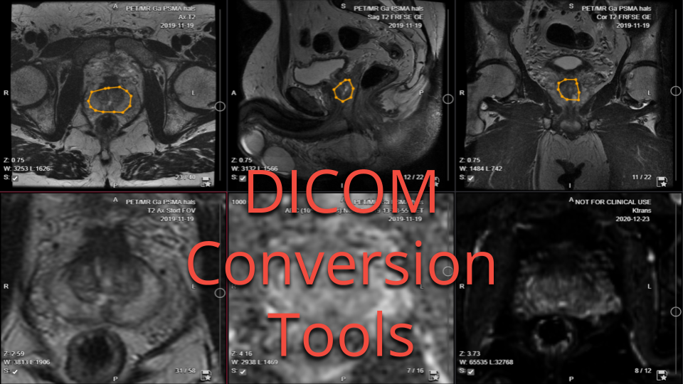 DICOM to STL Conversion | Best Tools, Methods & Libraries