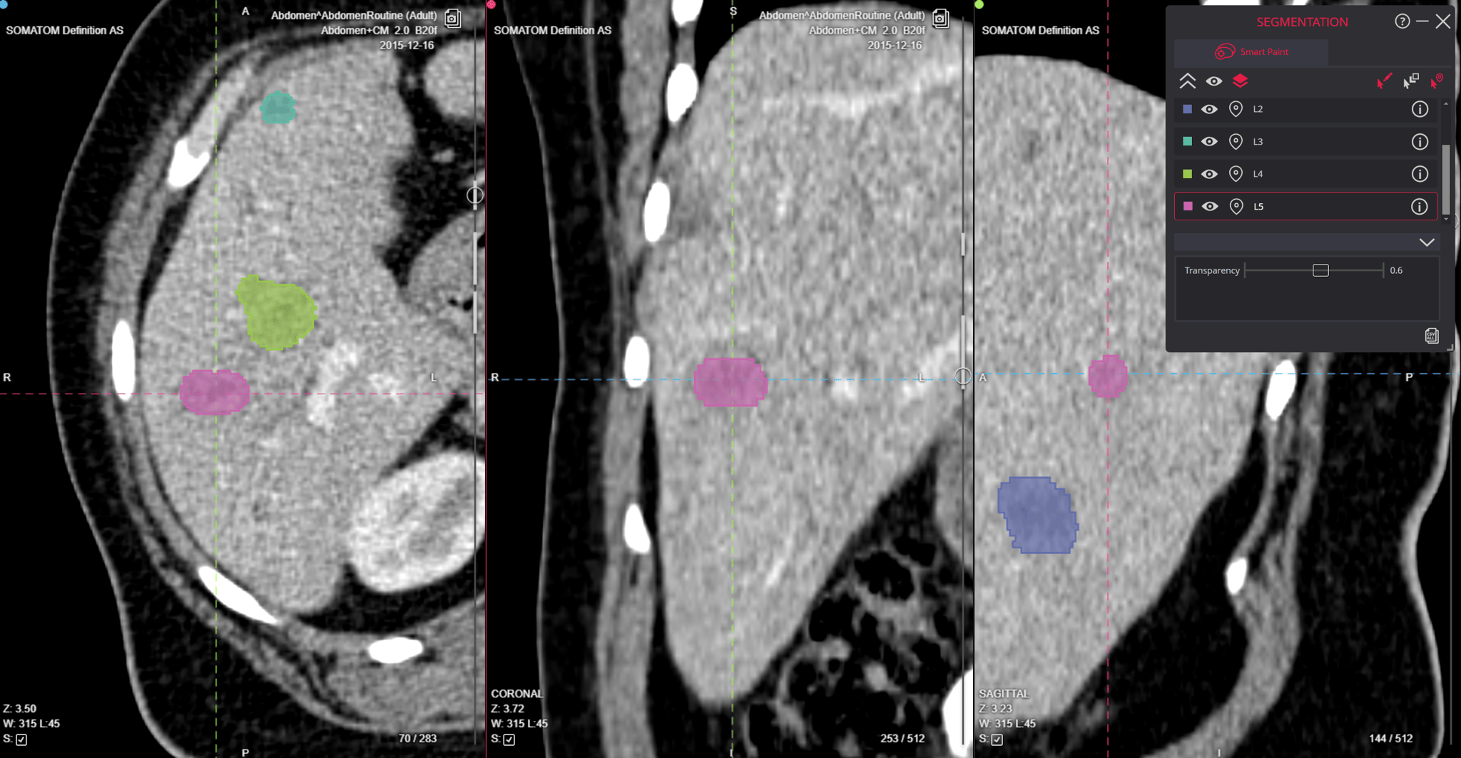 2025 Guide to Medical Imaging Dataset Resources