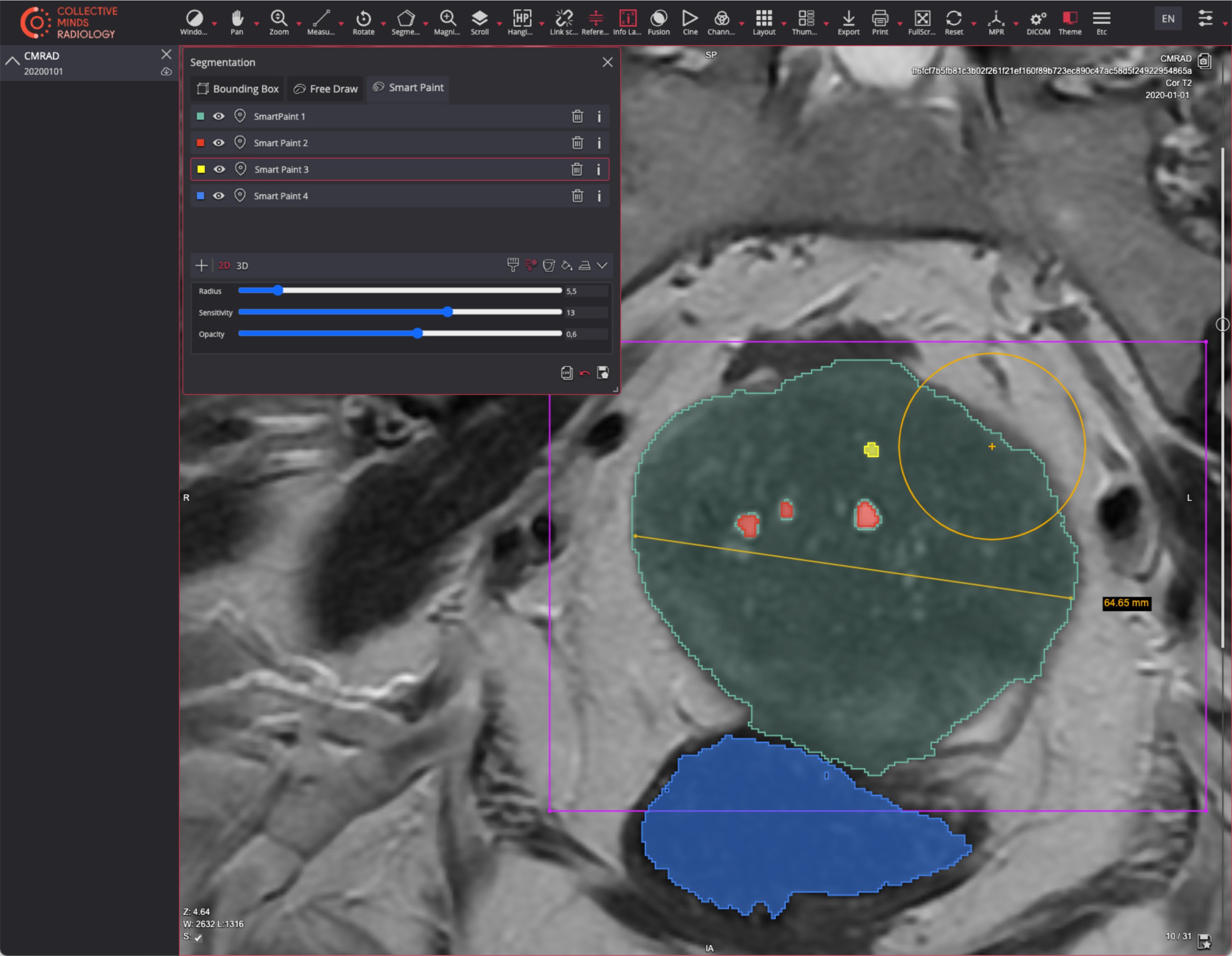 DICOM Annotation Guide | Medical Image Labeling Explained